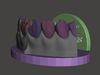Segmented Anterior Class IV and Class VI by EDM DENTAL PRACTICE 3D ...