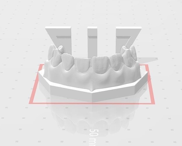 Segmented Anterior Direct Veneer by EDM DENTAL PRACTICE 3D model 3D ...