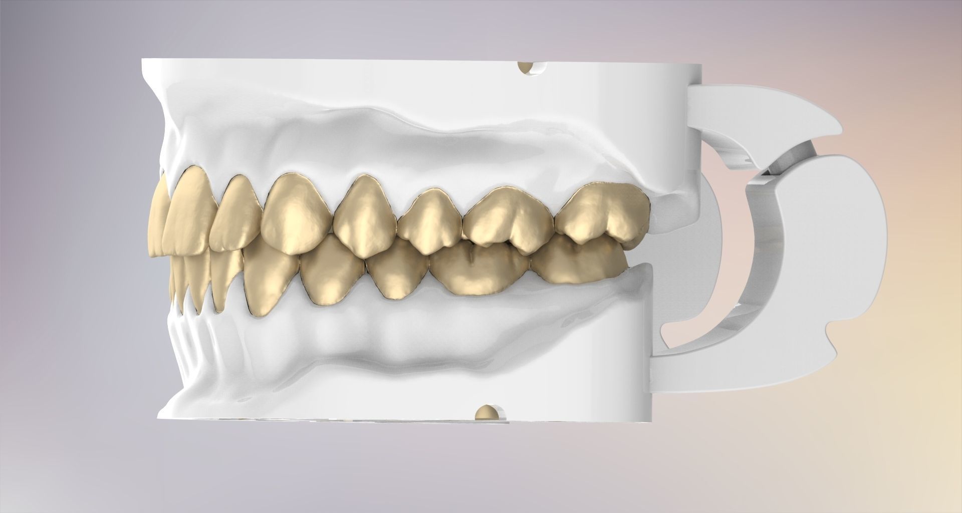 3D Dental Jaws Replica with Detachable Teeth 3D model 3D printable ...