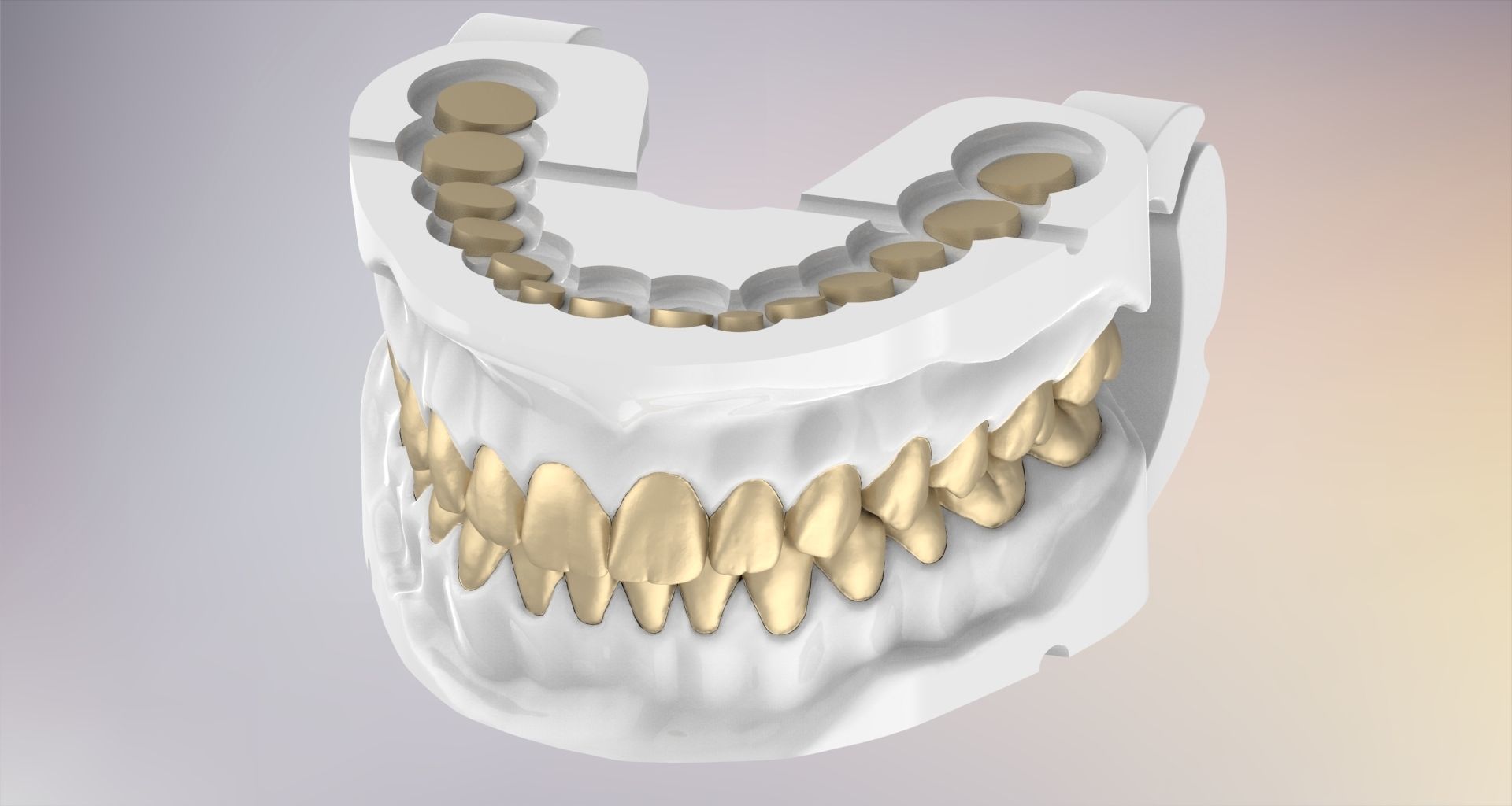 3D Dental Jaws Replica with Detachable Teeth 3D model 3D printable ...