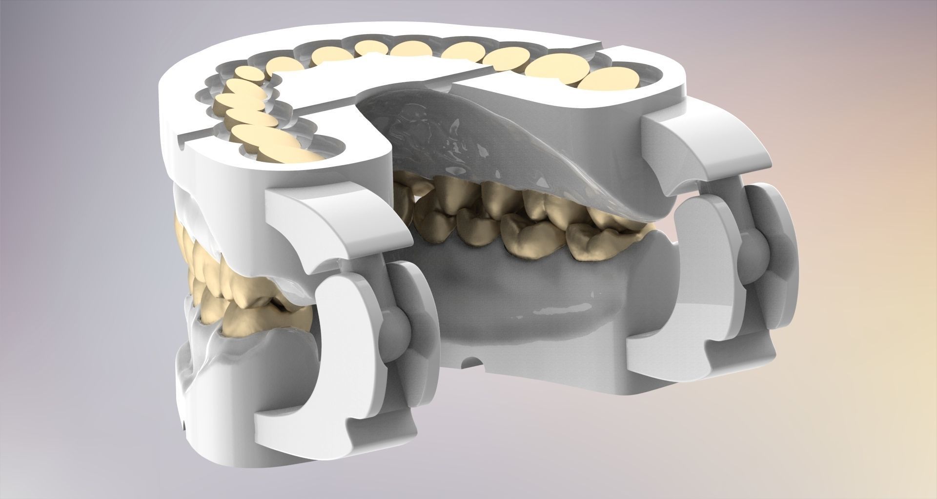 3D Dental Jaws Replica with Detachable Teeth 3D model 3D printable ...