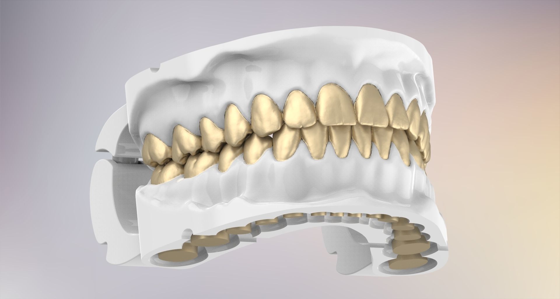3D Dental Jaws Replica with Detachable Teeth 3D model 3D printable ...