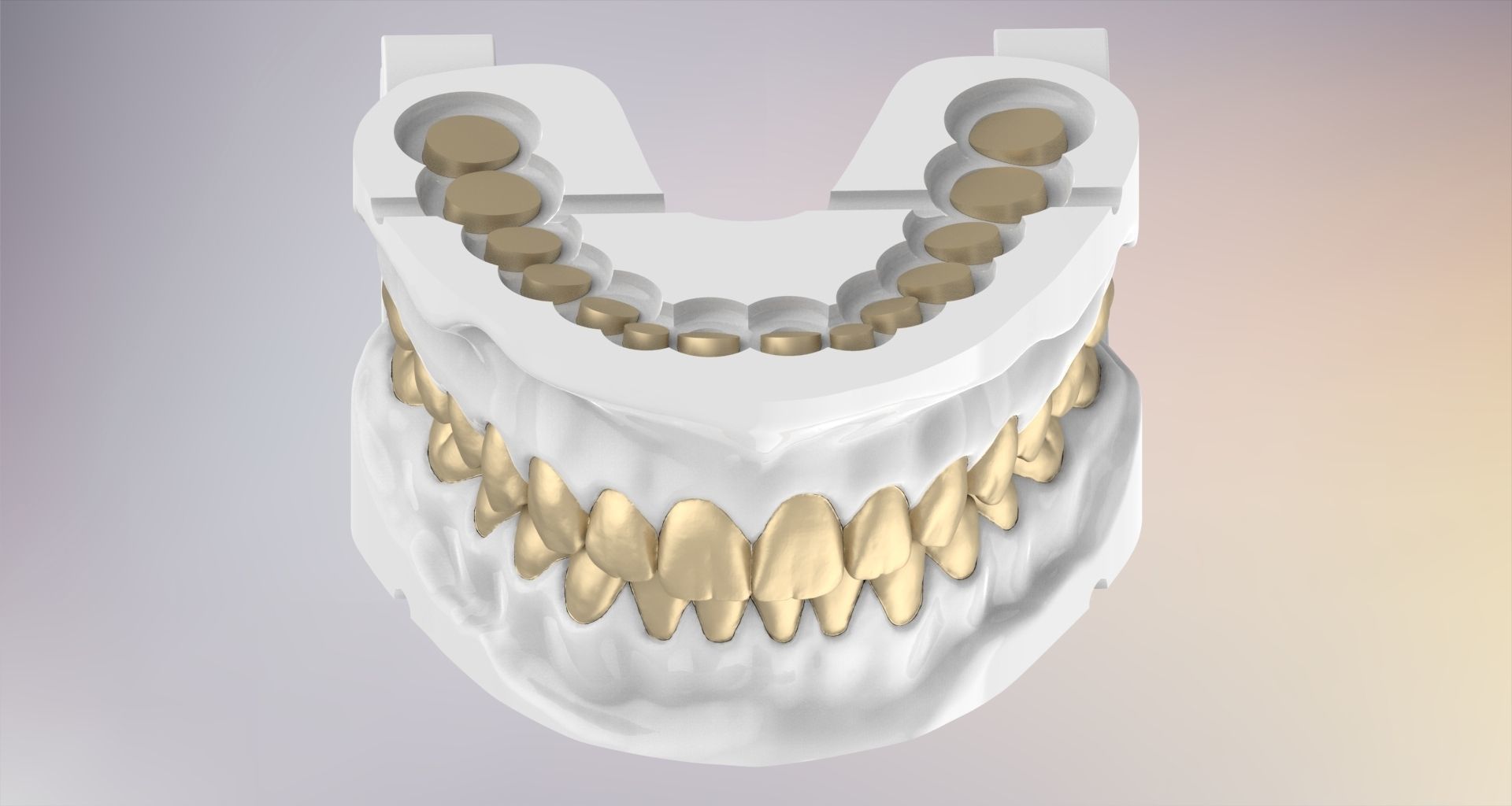 3D Dental Jaws Replica with Detachable Teeth 3D model 3D printable ...