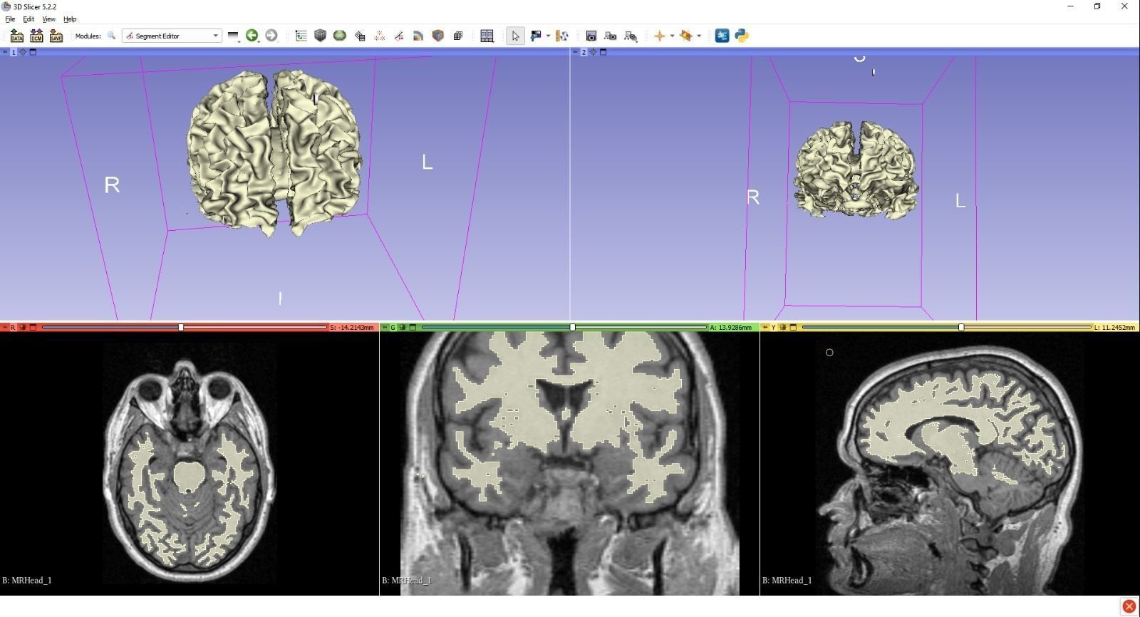 White matter of the brain 3D model 3D printable | CGTrader