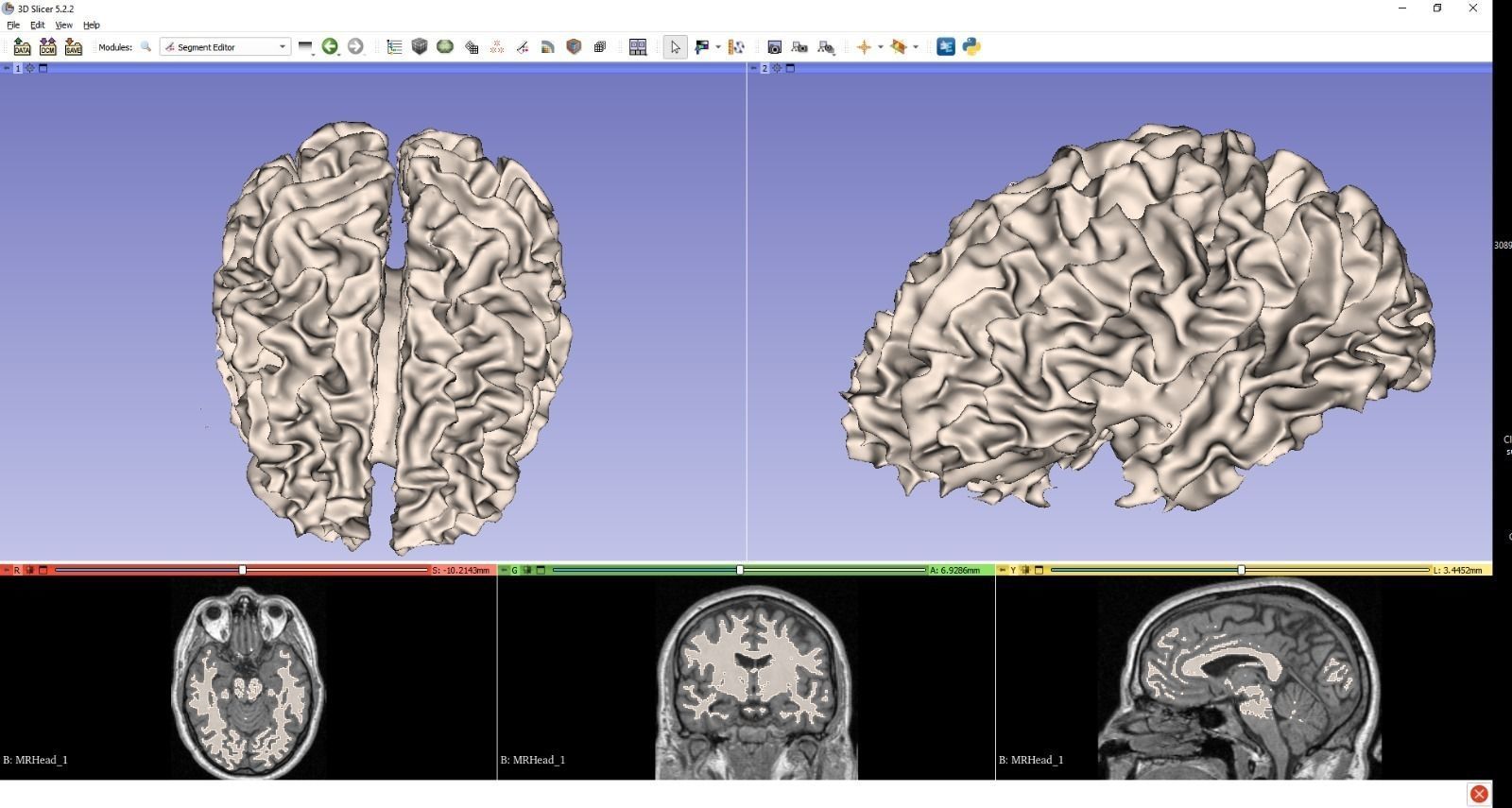 White matter of the brain 3D model 3D printable | CGTrader