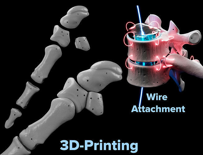 Wire attachment - 3D-Printing Skeletal System - PREVIEW free 3D model ...