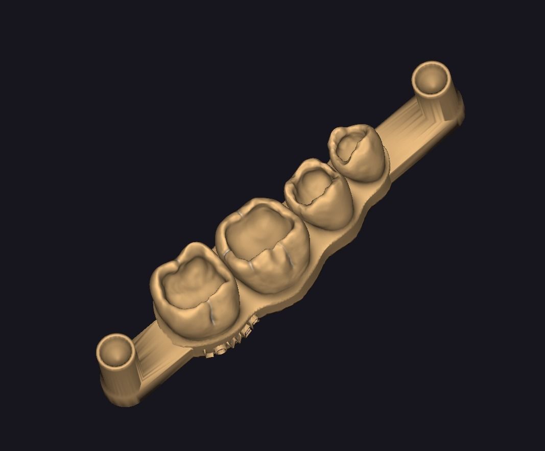 Dental training model Dental Sample model 3D print model 3D model 3D ...