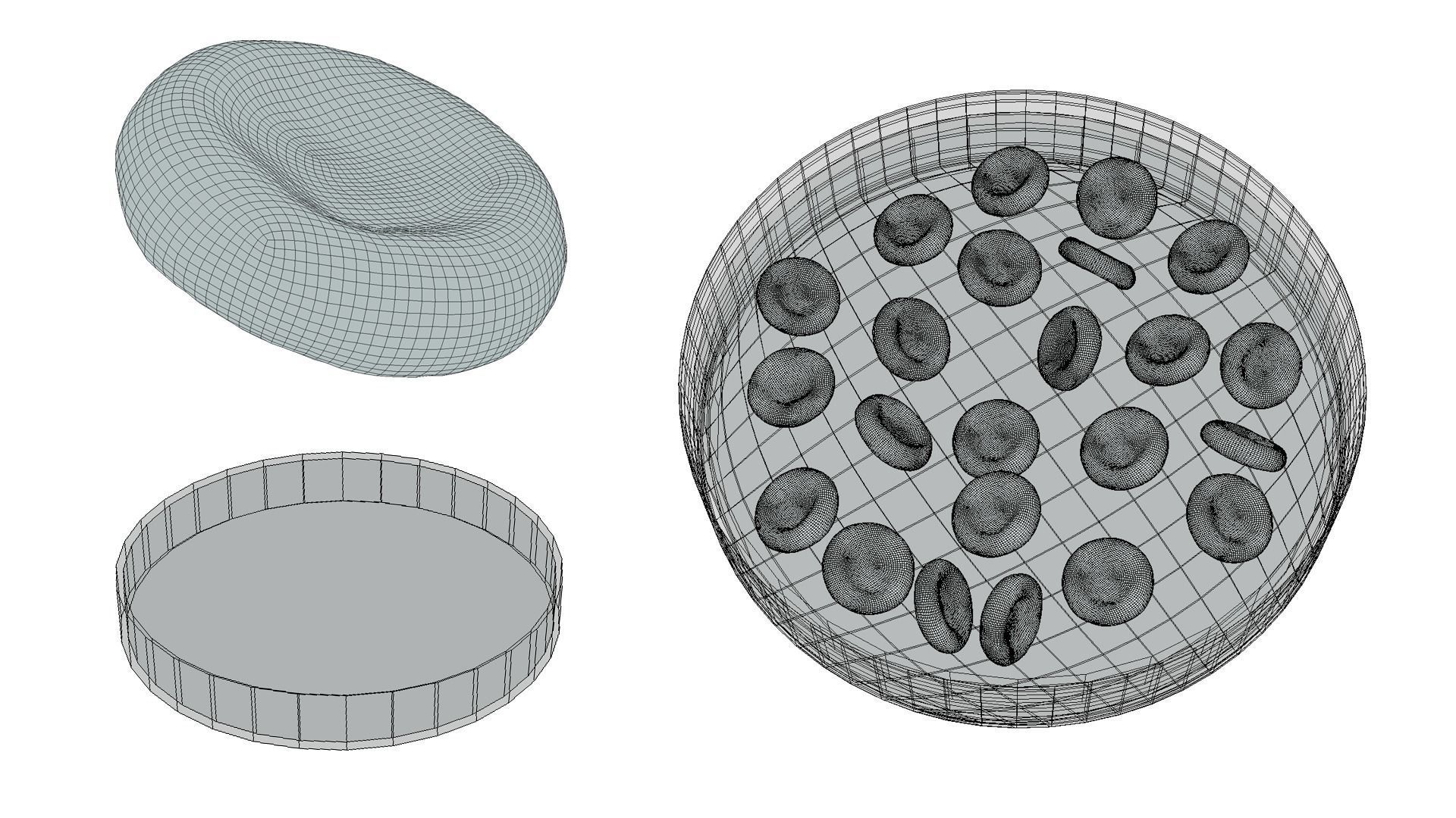 Normal Blood Cells vs Anemia 3D model | CGTrader
