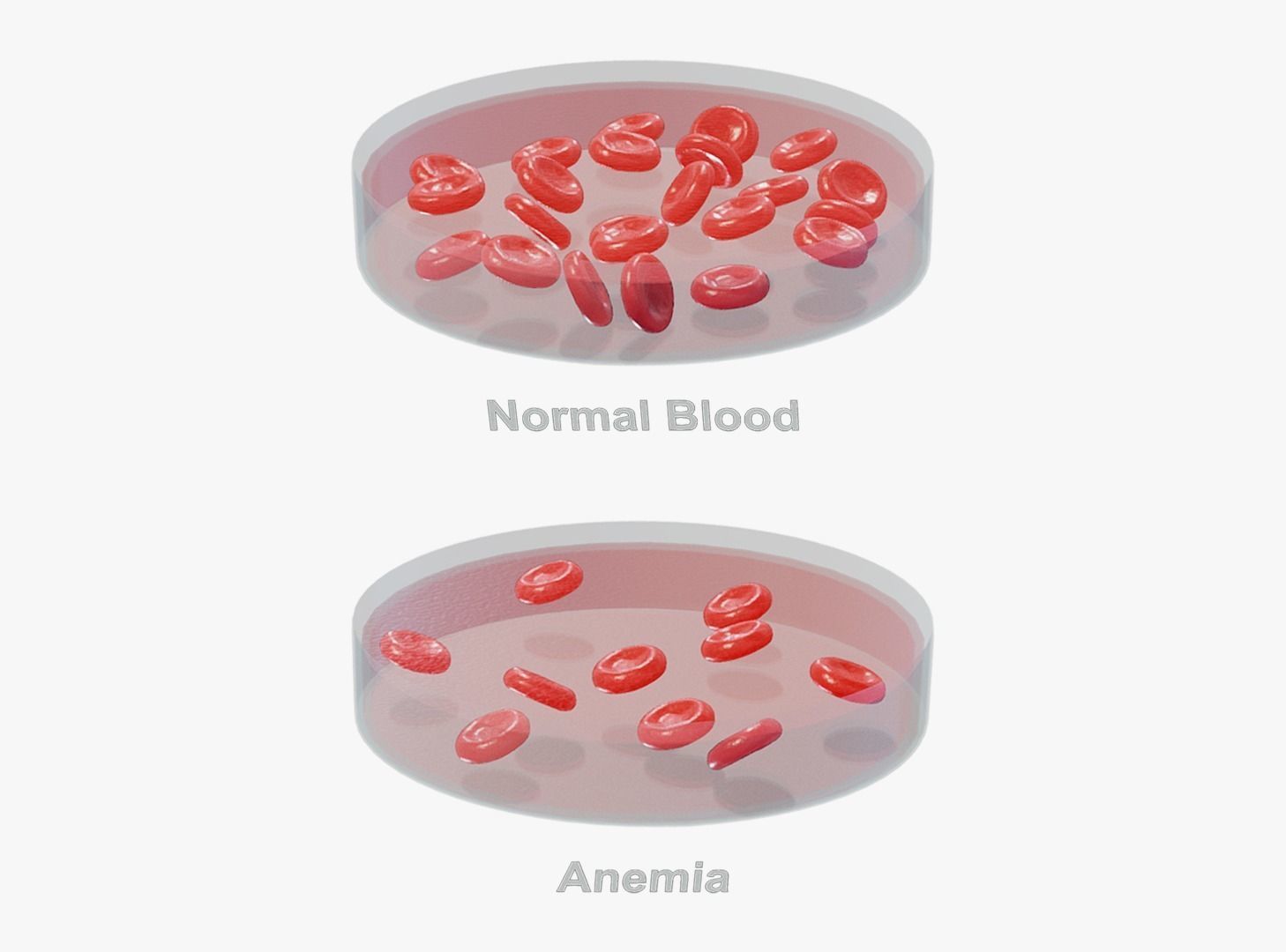 Normal Blood Cells vs Anemia 3D model | CGTrader