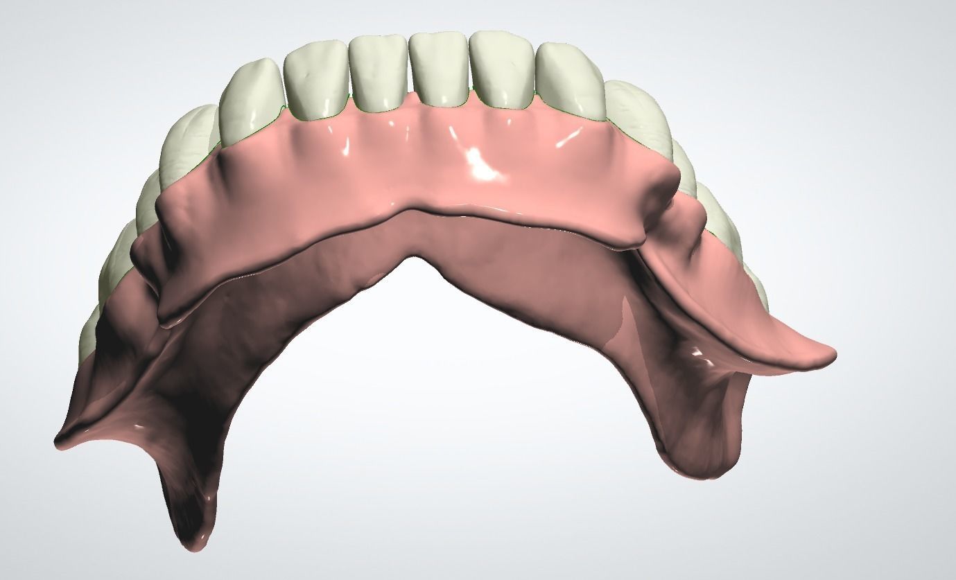 Digital full denture 3D model 3D printable | CGTrader
