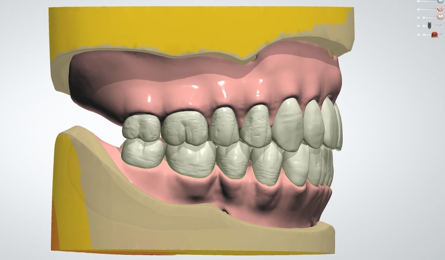 Digital full denture 3D model 3D printable | CGTrader