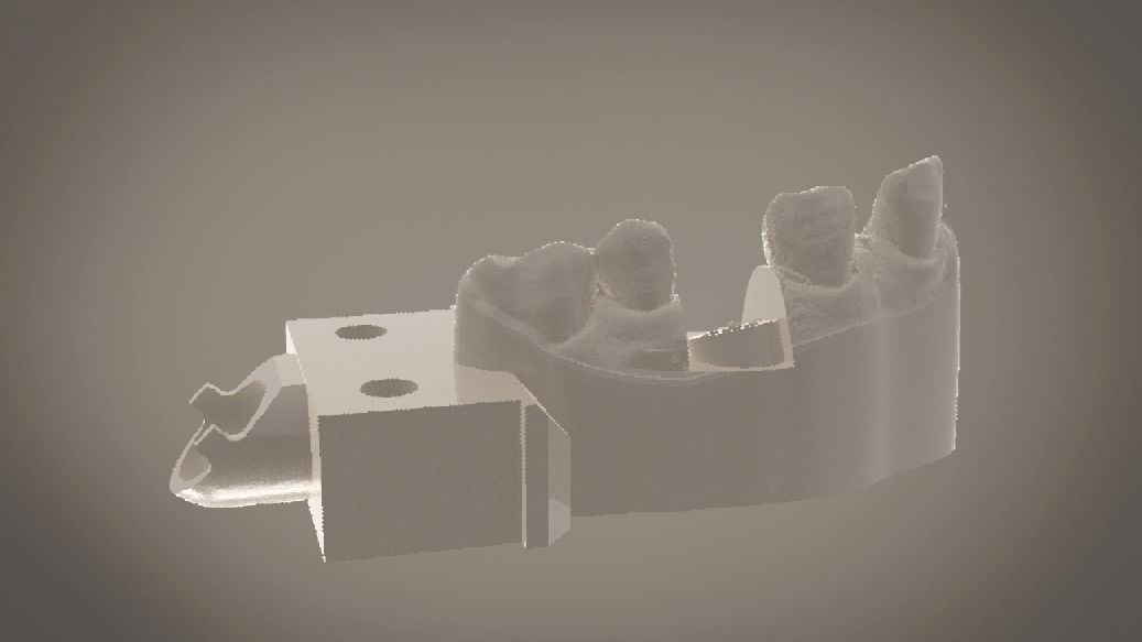 Digital Implant Model with Soft Tissue 3D model 3D printable | CGTrader